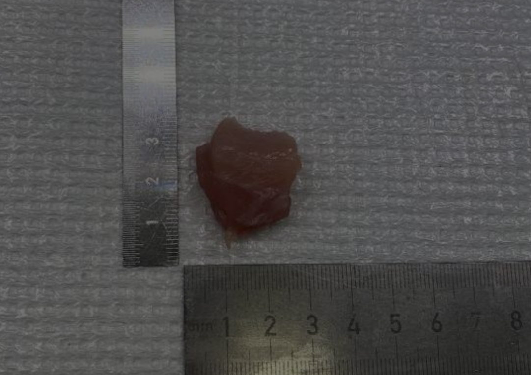 Klinisk patologi – CaseMedLab